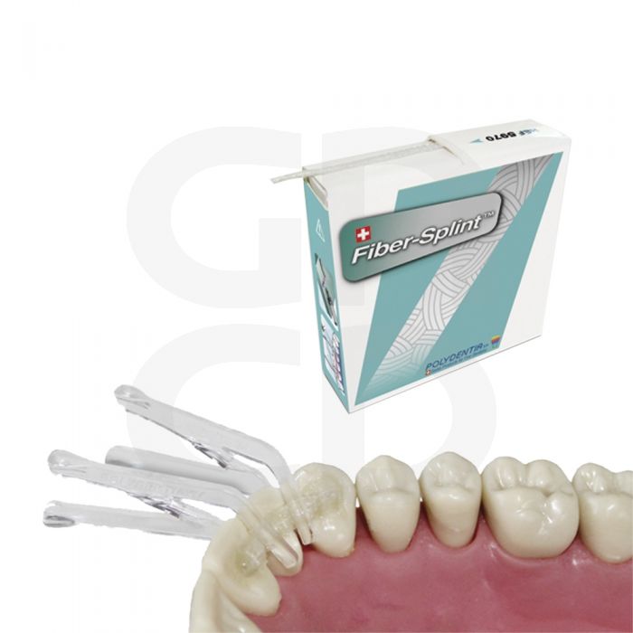 Clip&Splint - Le sachet de 30 pinces de fixation - POLYDENTIA
