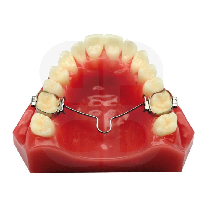 Arc Transpalatin Distal - SIA ORTHODONTIC